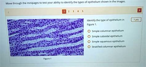Identify The Type Of Epithelium In Figure 1 Move Through The Minipages