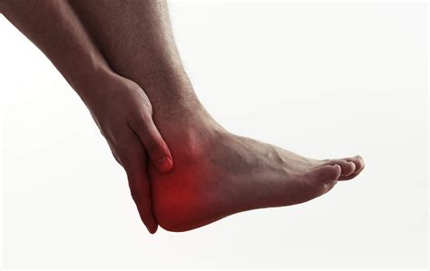 Calcaneal Apophysitis Specialists Best Diagnosis And Treatments Pfac