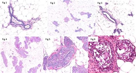 Figure 4 From Proliferative And Nonproliferative Lesions Of The Rat And