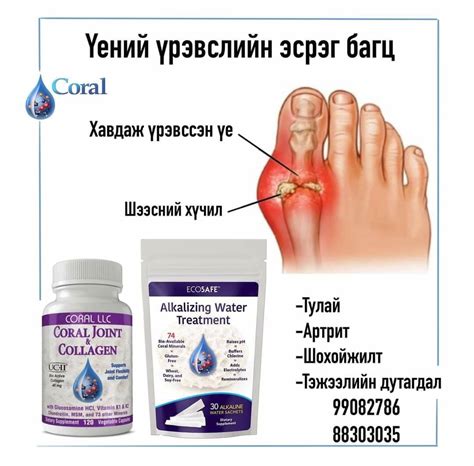 Яс ургалт шохойжилт үрэвсэл зогсоон Pregnositol Mongolia