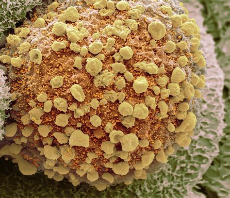 Sars Cov 2 Delta Variant Sem Stock Image C0536712 Science Photo Library