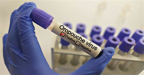 Virus Del Oropouche Se Propaga Por Toda Cuba Con Más De 600 Casos