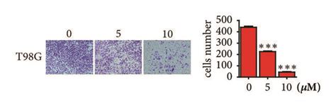 Effects Of Paeoniflorin On Proliferation Migration And Invasion And