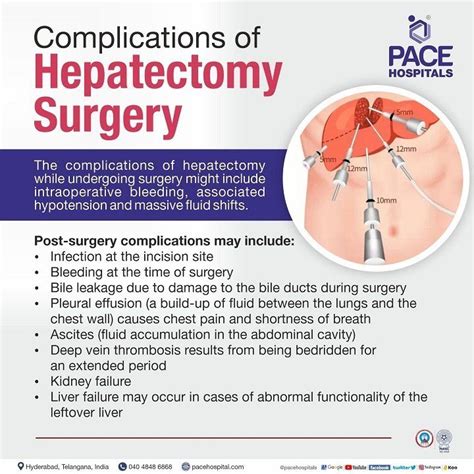 Hepatectomy Surgery In Hyderabad Types Procedure Indications And Cost