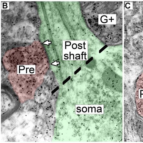 Electron Micrographs Showing Examples Of Gabaergic Synapses With