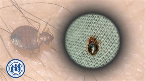 Bed Bugs Prevention What Can I Do