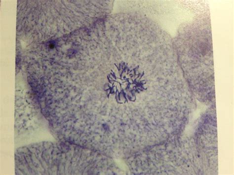 Bio Mitosis Microscope Lab Flashcards Quizlet