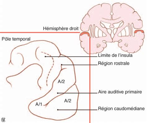 Anatomie Du Cortex Auditif Le Cortex Auditif Est Situé Sur La Partie