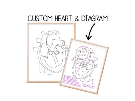 Custom Chd Heart Illustration Diagram Digital File Simple Black And White