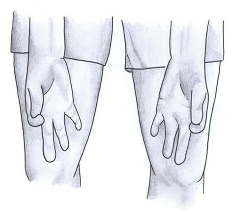 Musculoskeletal Assessment Pgals Questions And Examination Arthritis Uk