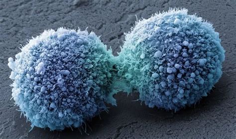 Nature子刊：缺氧是导致癌细胞不断肆虐的元凶 广州复大肿瘤医院
