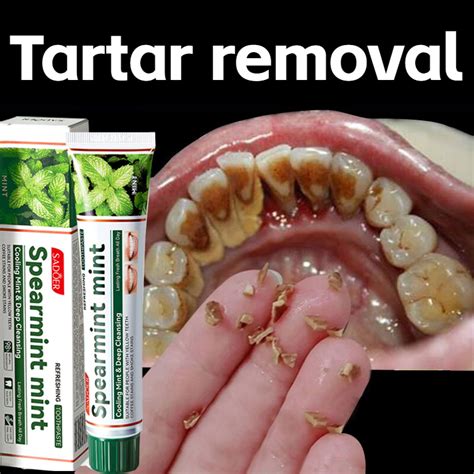 Teeth Whitening Toothpaste Teeth Removal Tartar Bad Breath Removal