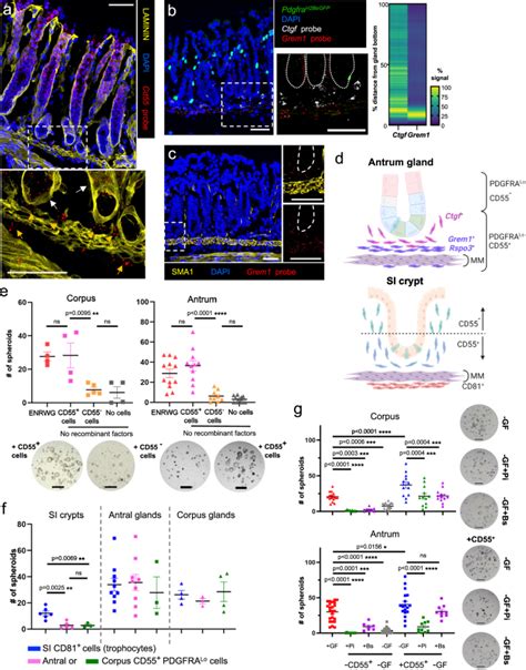 Role Of Pdgfra Cells And A Cd55 Pdgfralo Fraction In The Gastric