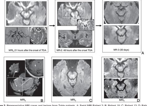 Figure 2 From Lack Of Evidence For Arterial Ischemia In Transient