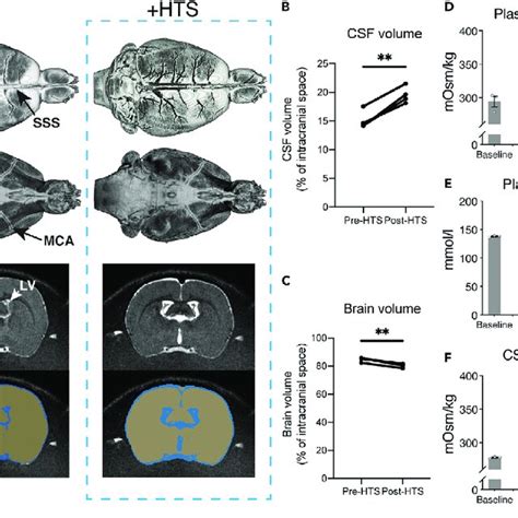 Systemic Hts Influences Brain Fluid Compartment Volumes And Osmolality Download Scientific