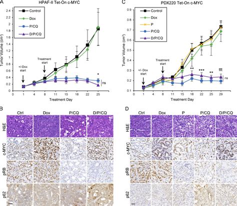 P Cq Prevents Growth Of Pdac Xenografts That Express Elevated C Myc Download Scientific