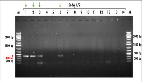 Figure 1 From Design Of A Molecular Method To Detect Streptococcus