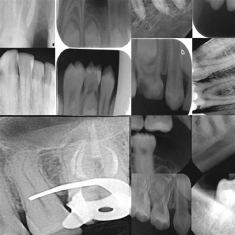 Mosaic Data Augmentation Teaches The Model To Recognize Objects In