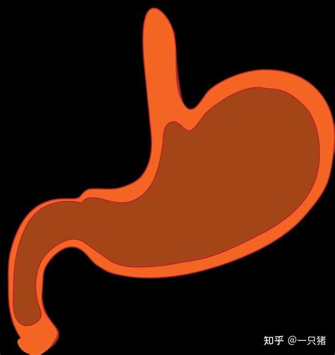 什么是胃食管反流病？如何治疗？ 知乎