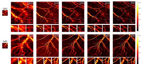 The Enhancement Of Two In Vivo AR PAM Imaging Results A Low