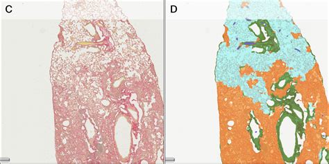 The Role Of Pre Clinical Bleomycin Models In Ipf Drug Development