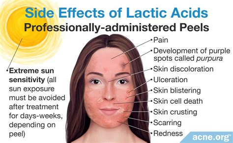 The Benefits Of Lactic Acid For Your Skin Heidi Salon