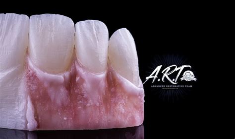 Jack Marrano Case 1 Miyo World