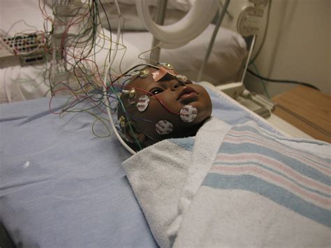 Aset Department Of Education Report Why Is Continuous Eeg In The