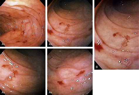 Duodenum And Small Bowel Abdominal Key