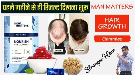 Man Matters Dht Blocker Anti Hair Fall Shampoo 200 Ml 55 Off