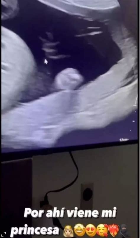 Anuel Aa La Primera Imagen De Cataleya La Hija Que Espera Con Yailin