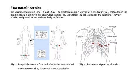 Basics Of Ecg Ppt