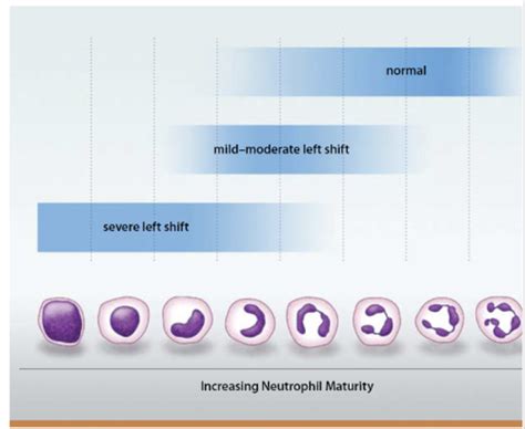 Exam CBC Flashcards Quizlet