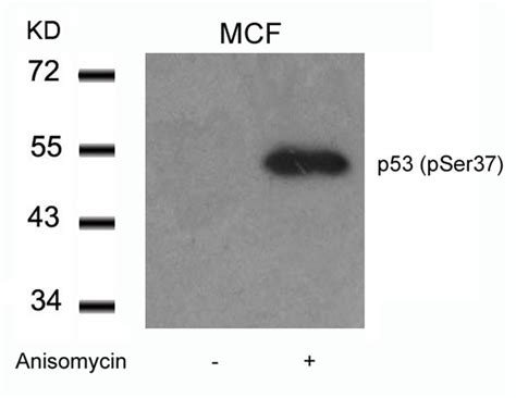 Anti P53 Phospho Ser37 Antibody Arg51600 Arigo Biolaboratories