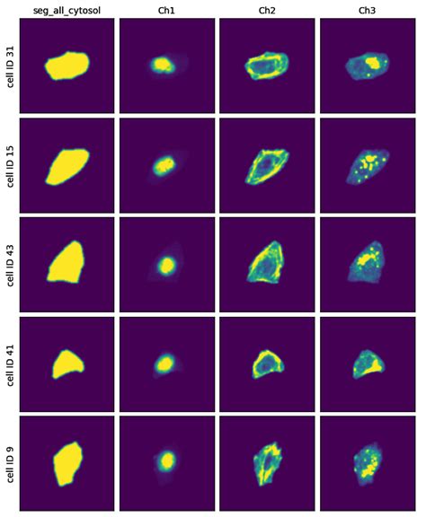 Different Segmentation Workflows ScPortrait
