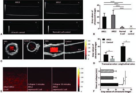 Ultrasound Imaging Of Arg Escherichia Coli Li In Vitro And Ex Download Scientific Diagram