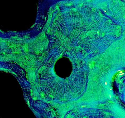 Compact Bone Light Micrograph Digital Art By Steve Gschmeissner