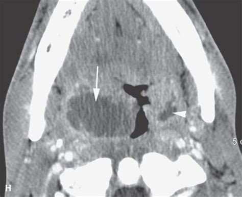 Infections And Noninfectious Inflammatory Disorders General Morphology