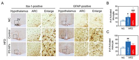 Polystyrene Microplastics Exacerbate Systemic Inflammation In High Fat