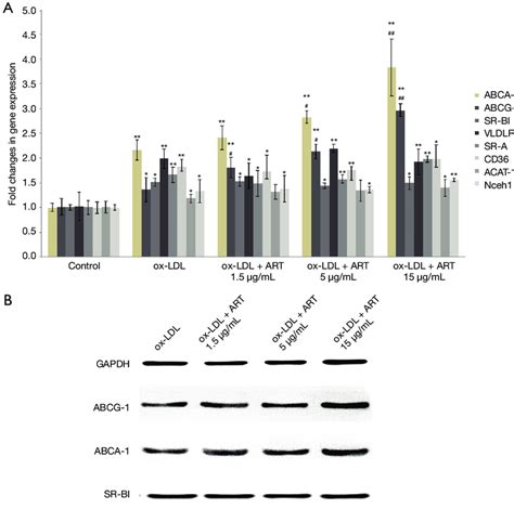 Art Increased Abca1 And Abcg1 Expression In Thp 1 Derived Macrophages