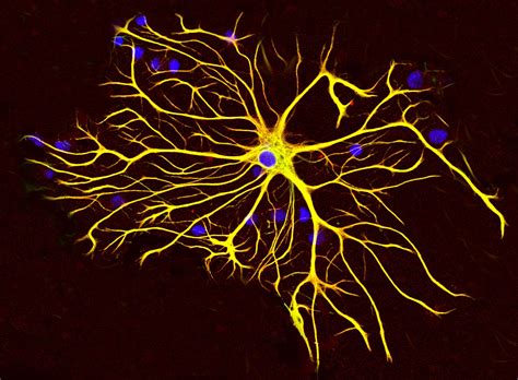 Association Neuron Bipolar