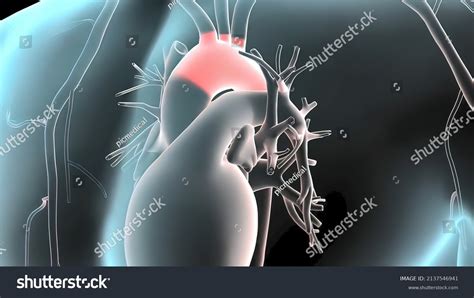 3d Medical Illustration Pulsatile Abdominal Aortic Stock Illustration 2137546941 Shutterstock