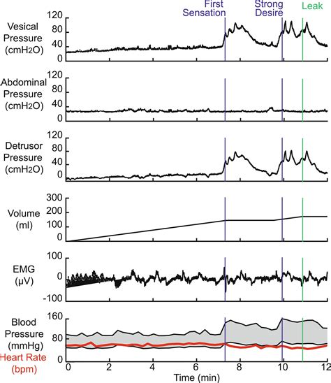 Spinal Cord Epidural Stimulation For Autonomic Nervous System Control