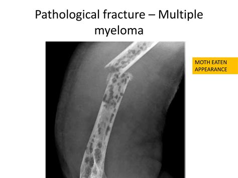 Interpretation Of Musculoskeletal X Rays Pptx