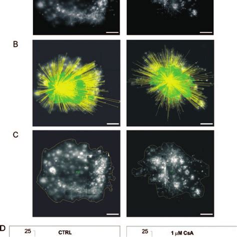 Migration Of Glioblastoma Cells In Organotypic Brain Slice Cultures