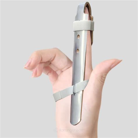 Extended Baseball Splint Docuses Healthcare