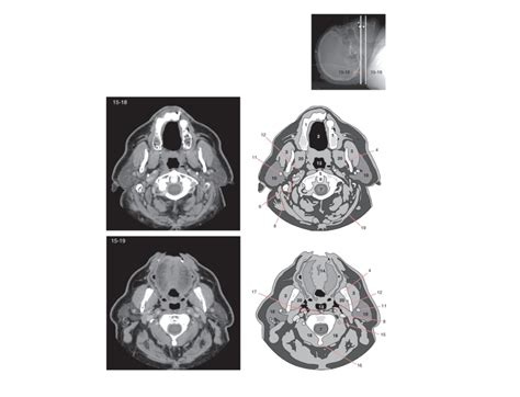 P206 Ch 15 Neck Diagram Quizlet