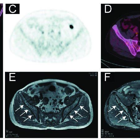 Representative Case Of A 30 Year Old Female Diagnosed With Diffuse Download Scientific Diagram