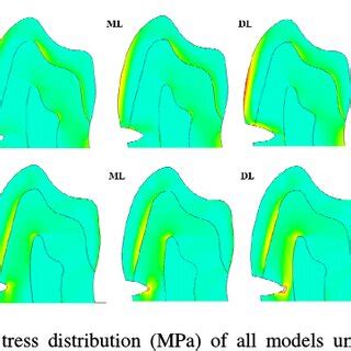 Maximum Principal Stress Distribution MPa Of All Models Under
