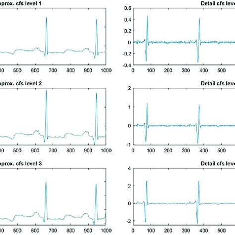 approximation and detailed coefficients of noisy ecg signal using swt